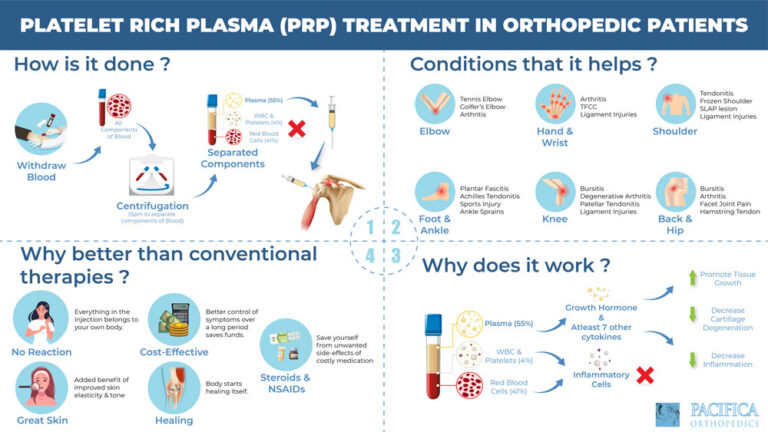 Infographic - Platelet-Rich Plasma Therapy - Pacifica Orthopedics ...